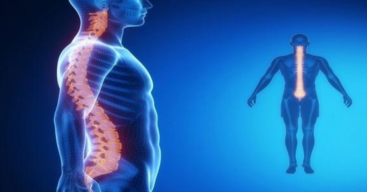 Curso Rápido grátis de Curso de noções básicas em avaliação postural